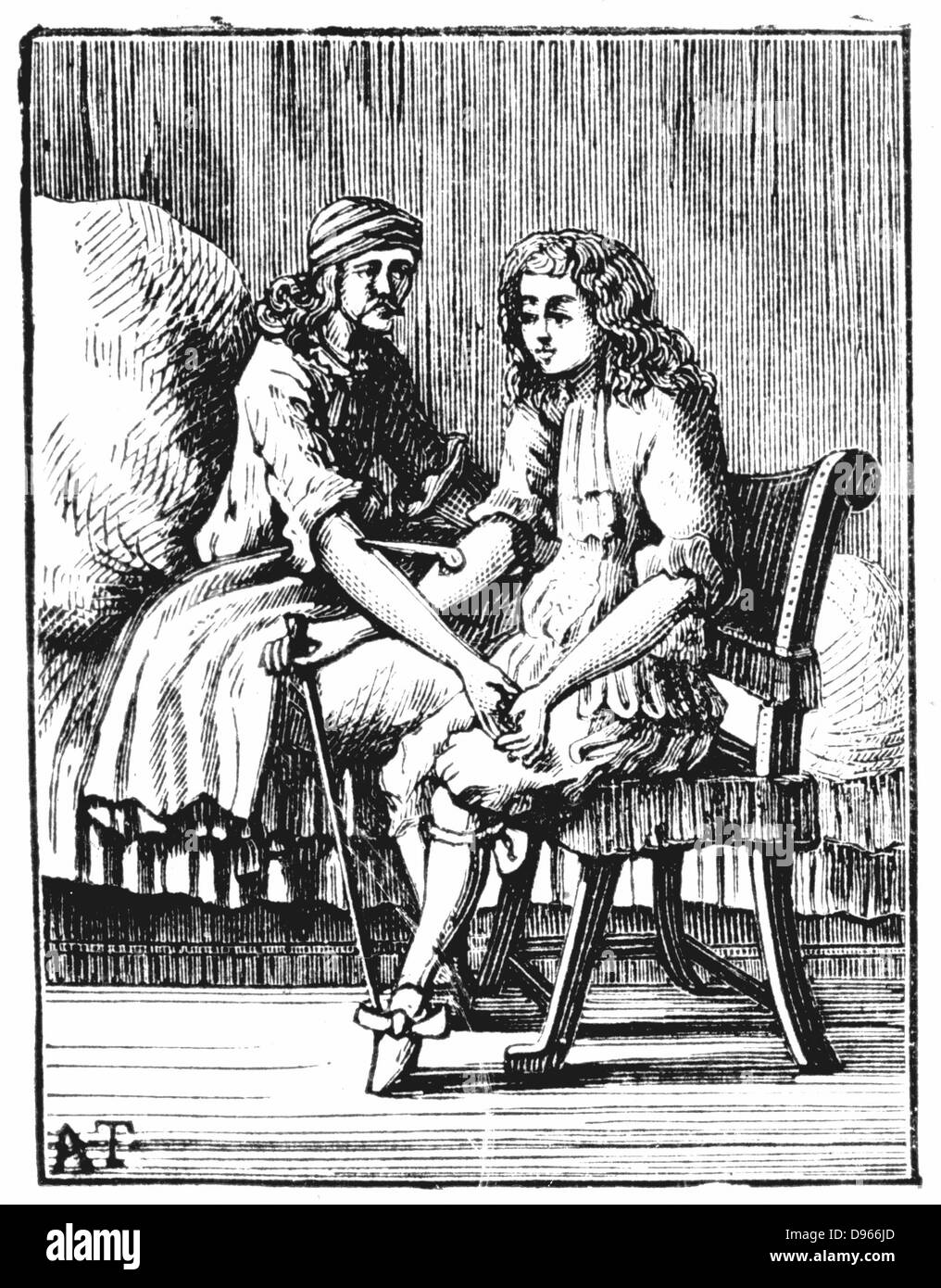 Direct person-to-person blood transfusion. After engraving from George ...