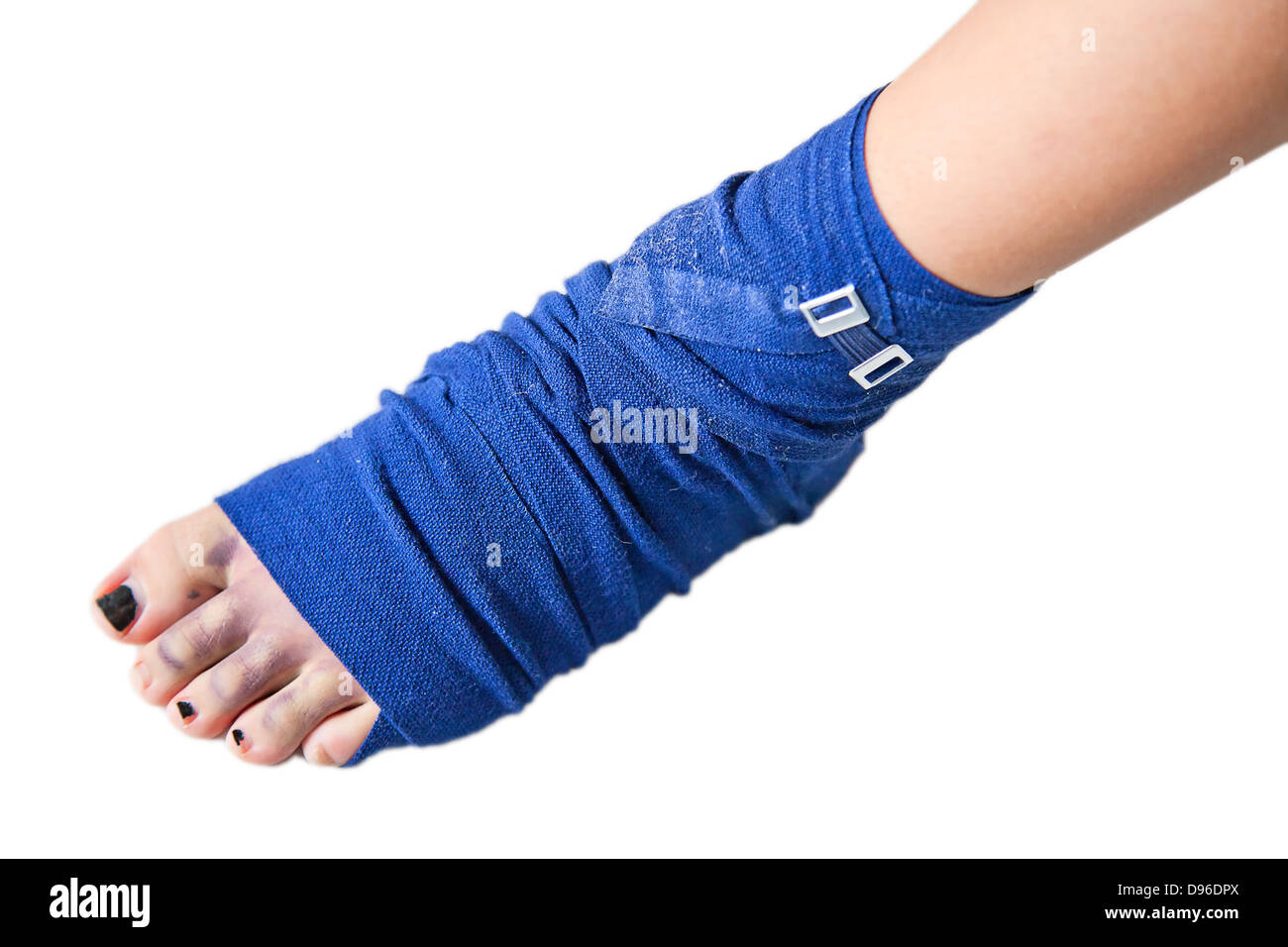 Injured foot isolated on white Stock Photo - Alamy