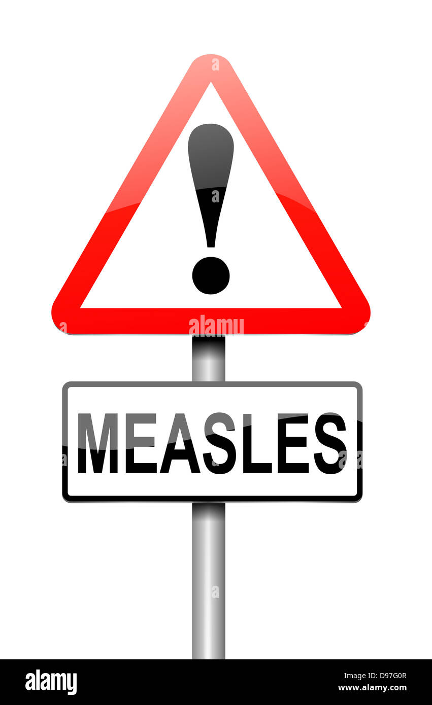 Measles sickness hi-res stock photography and images - Alamy