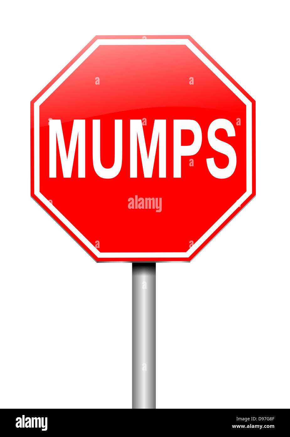 Mumps swollen glands hi-res stock photography and images - Alamy