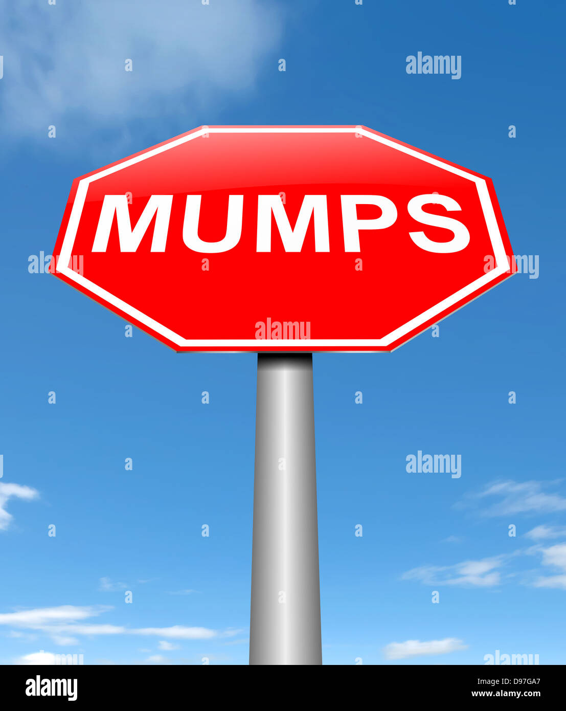 Mumps swollen glands hi-res stock photography and images - Alamy