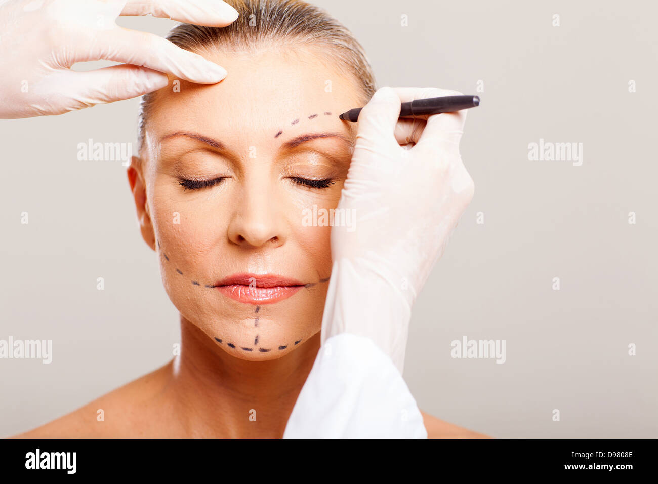 senior woman with correcting marks before face lifting Stock Photo - Alamy