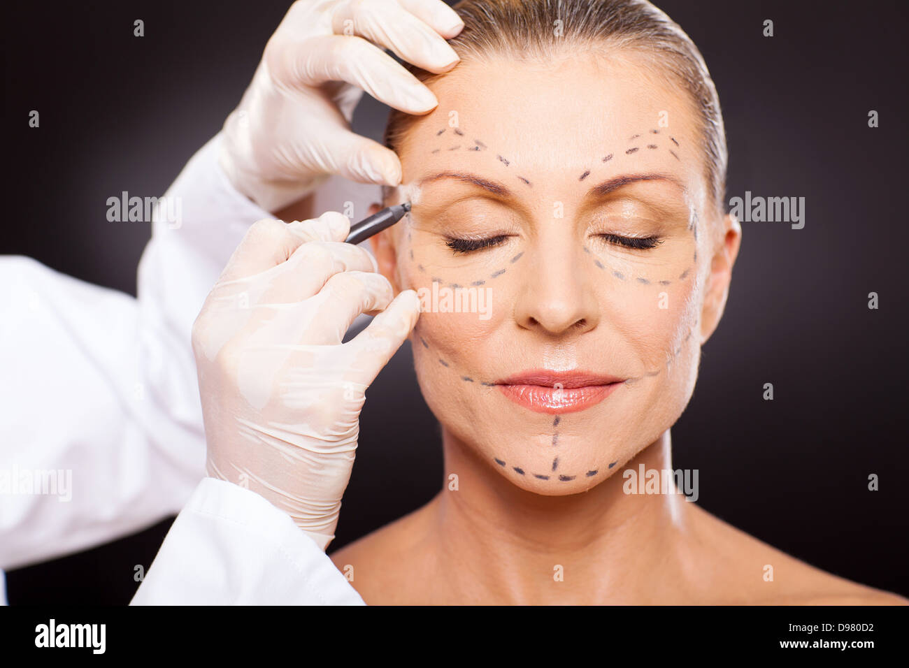 middle aged woman with correction marks preparing for plastic surgery ...