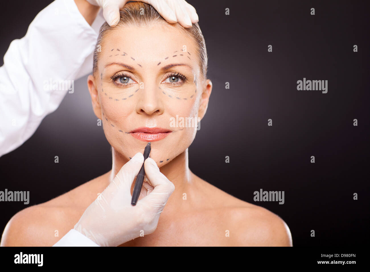 mid age woman with correction mark for plastic surgery Stock Photo - Alamy
