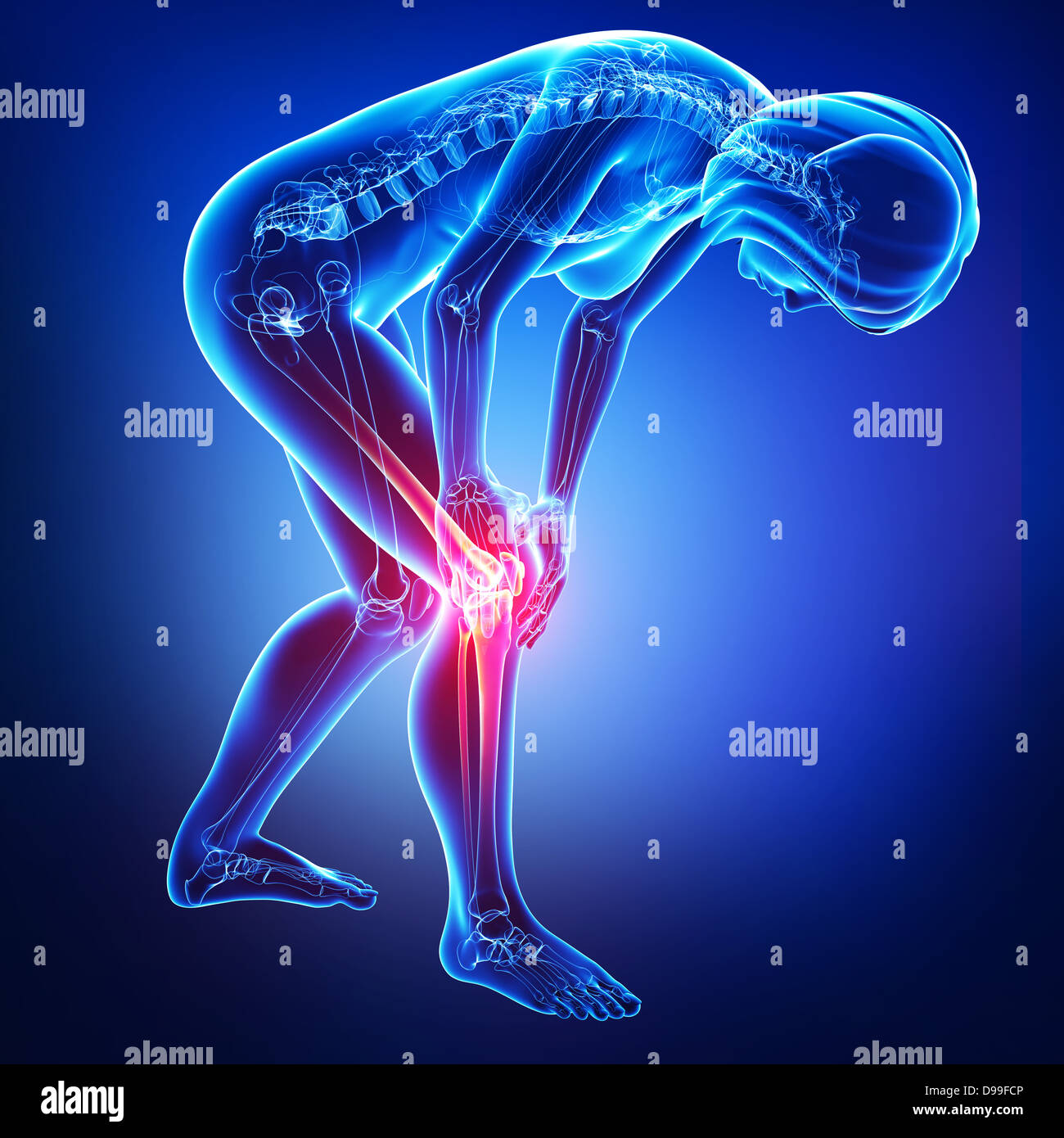 human knee pain anatomy in blue Stock Photo - Alamy