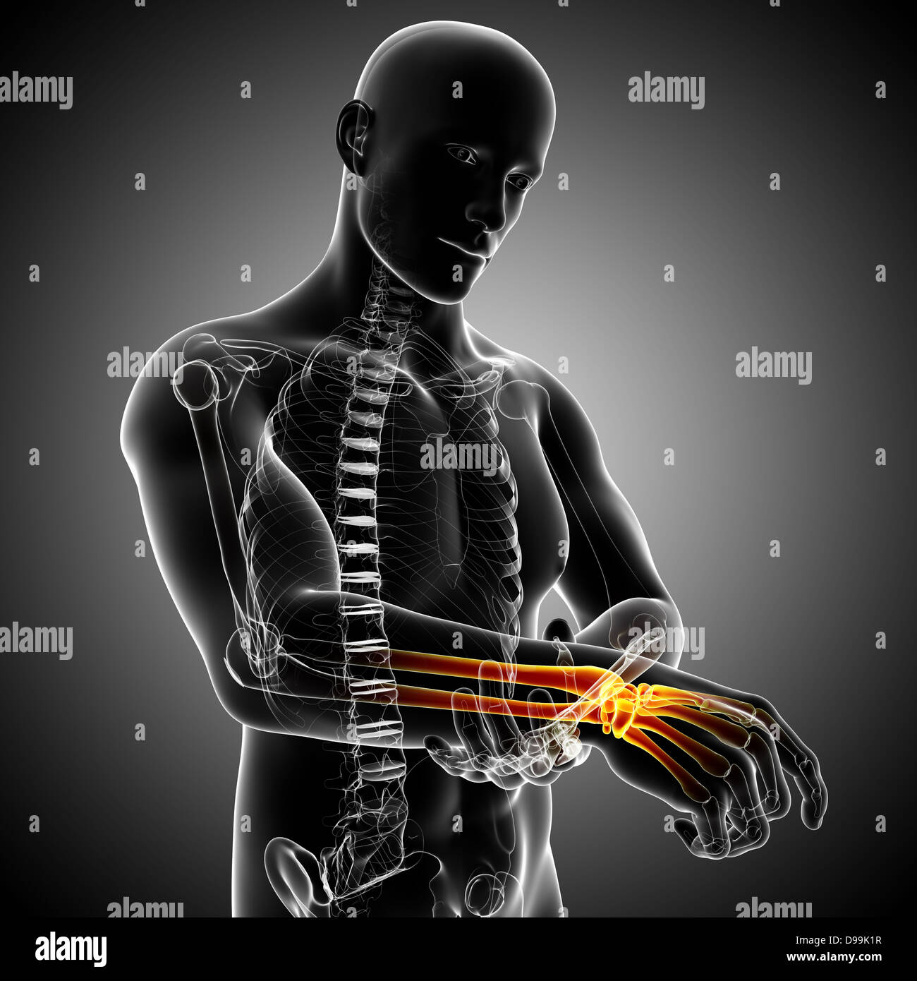 Hand x ray hi-res stock photography and images - Alamy