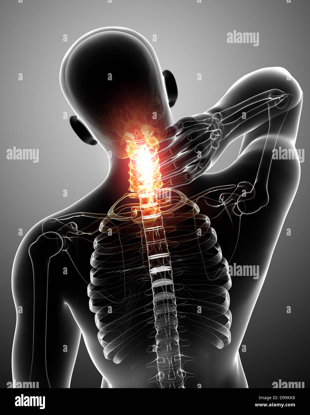 anatomy of male neck pain Stock Photo - Alamy