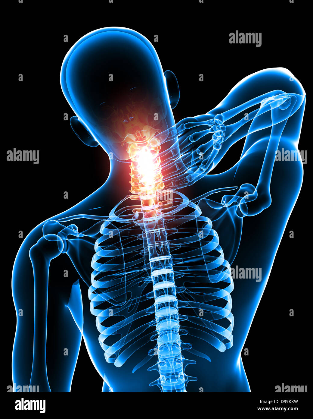 anatomy of male neck pain Stock Photo - Alamy
