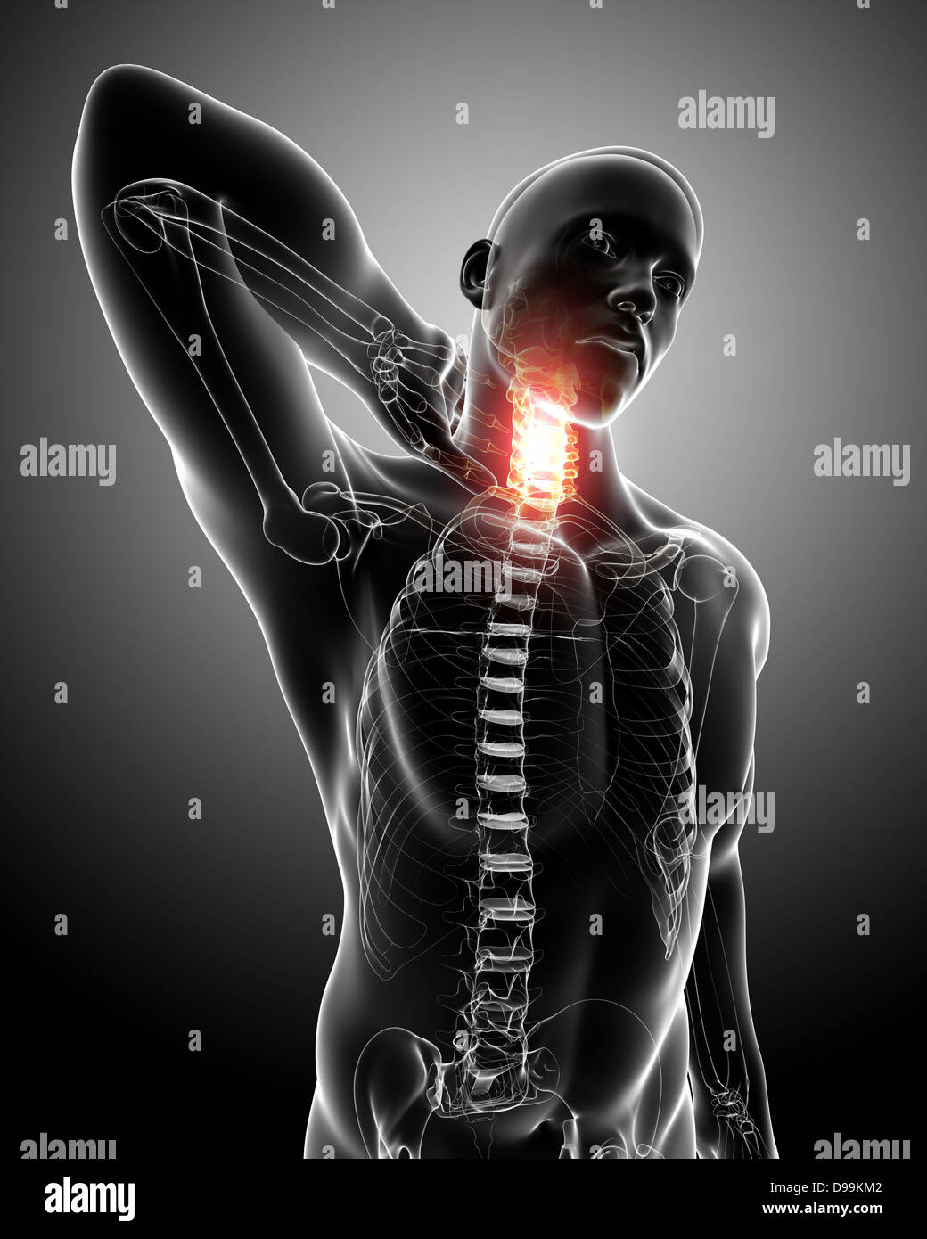 anatomy of male neck pain Stock Photo - Alamy