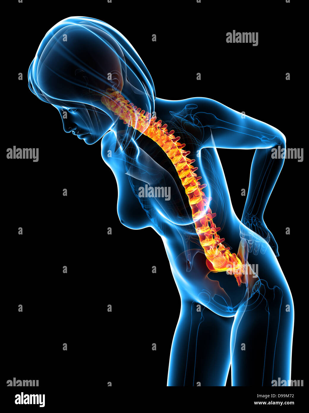 Human back pain anatomy Stock Photo - Alamy