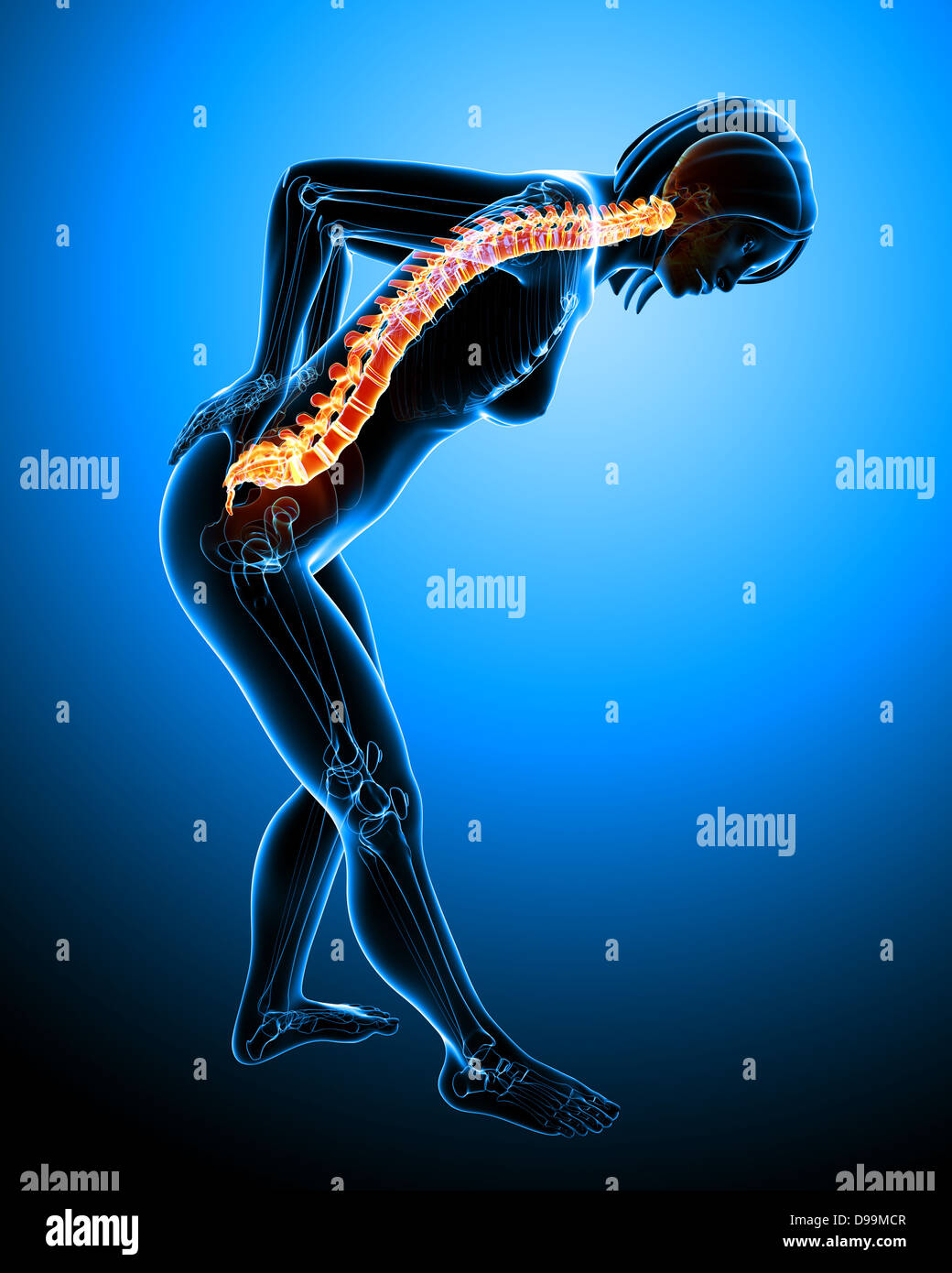 Human back pain anatomy Stock Photo - Alamy