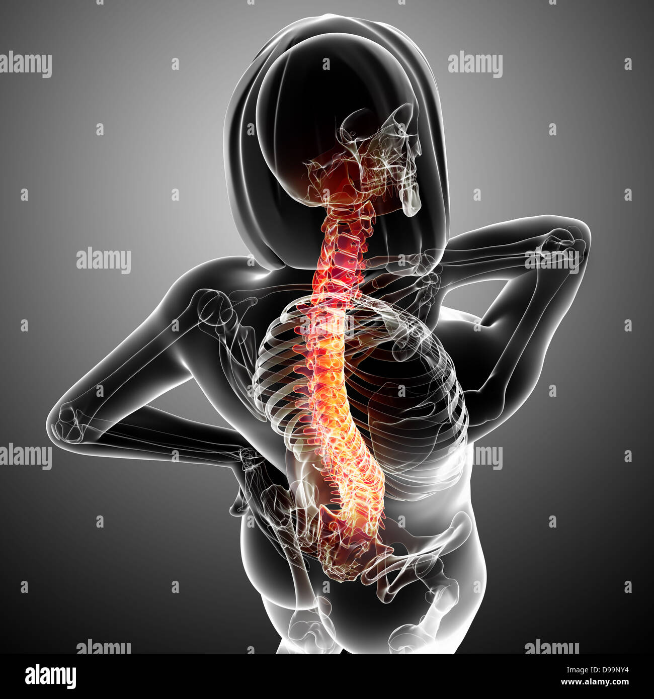 Human back pain anatomy Stock Photo - Alamy