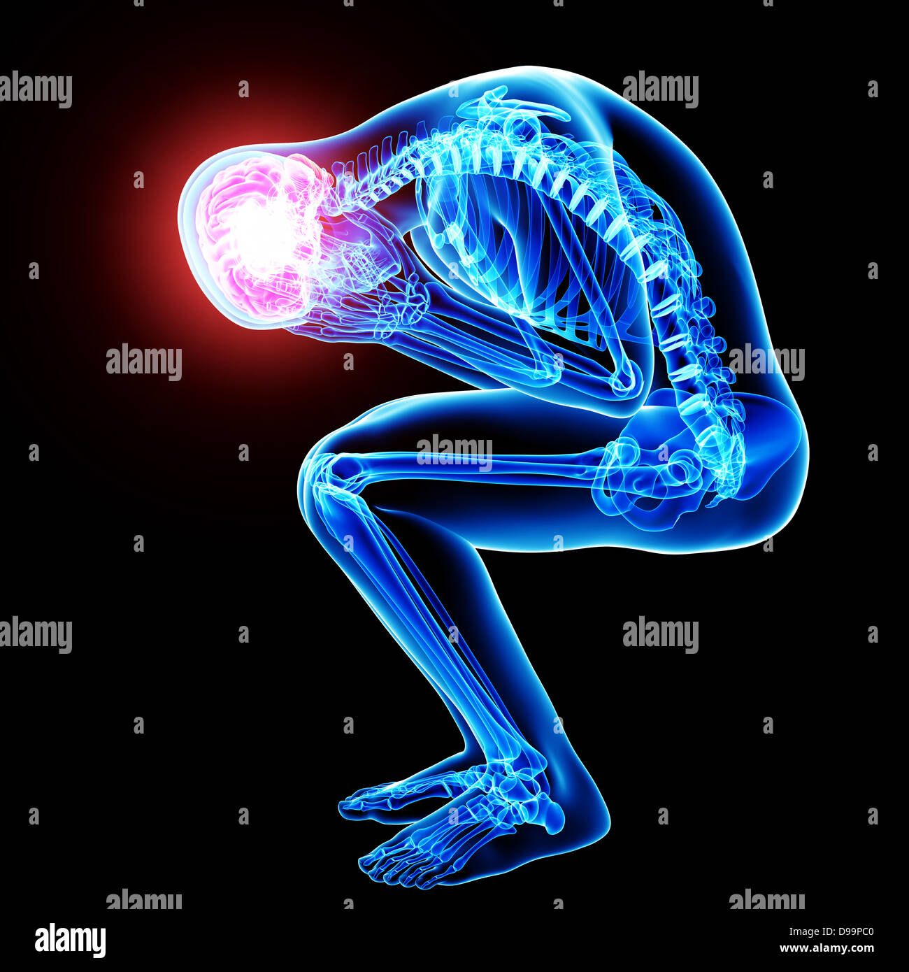 Human headache anatomy Stock Photo - Alamy