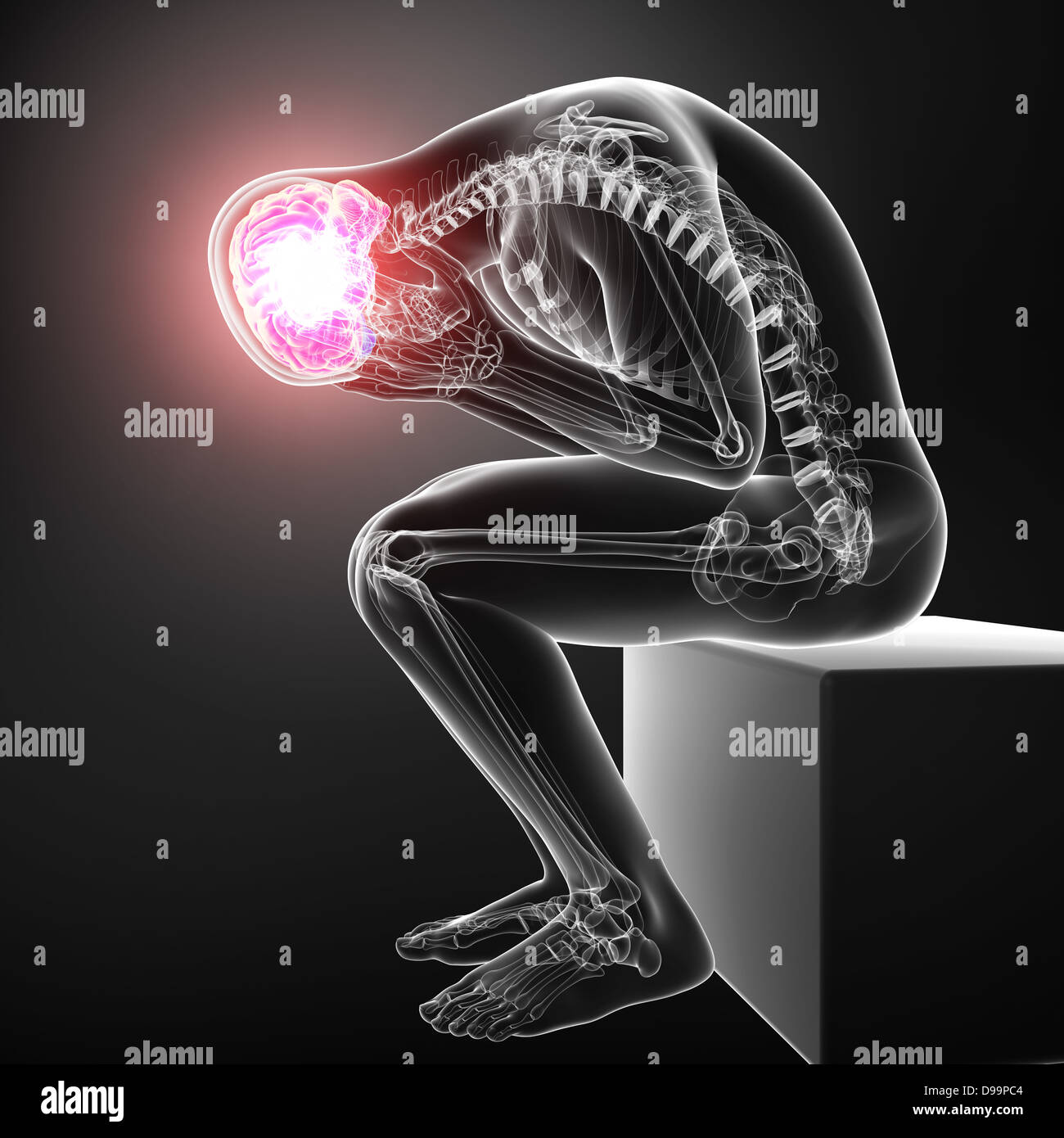 Human headache anatomy Stock Photo - Alamy
