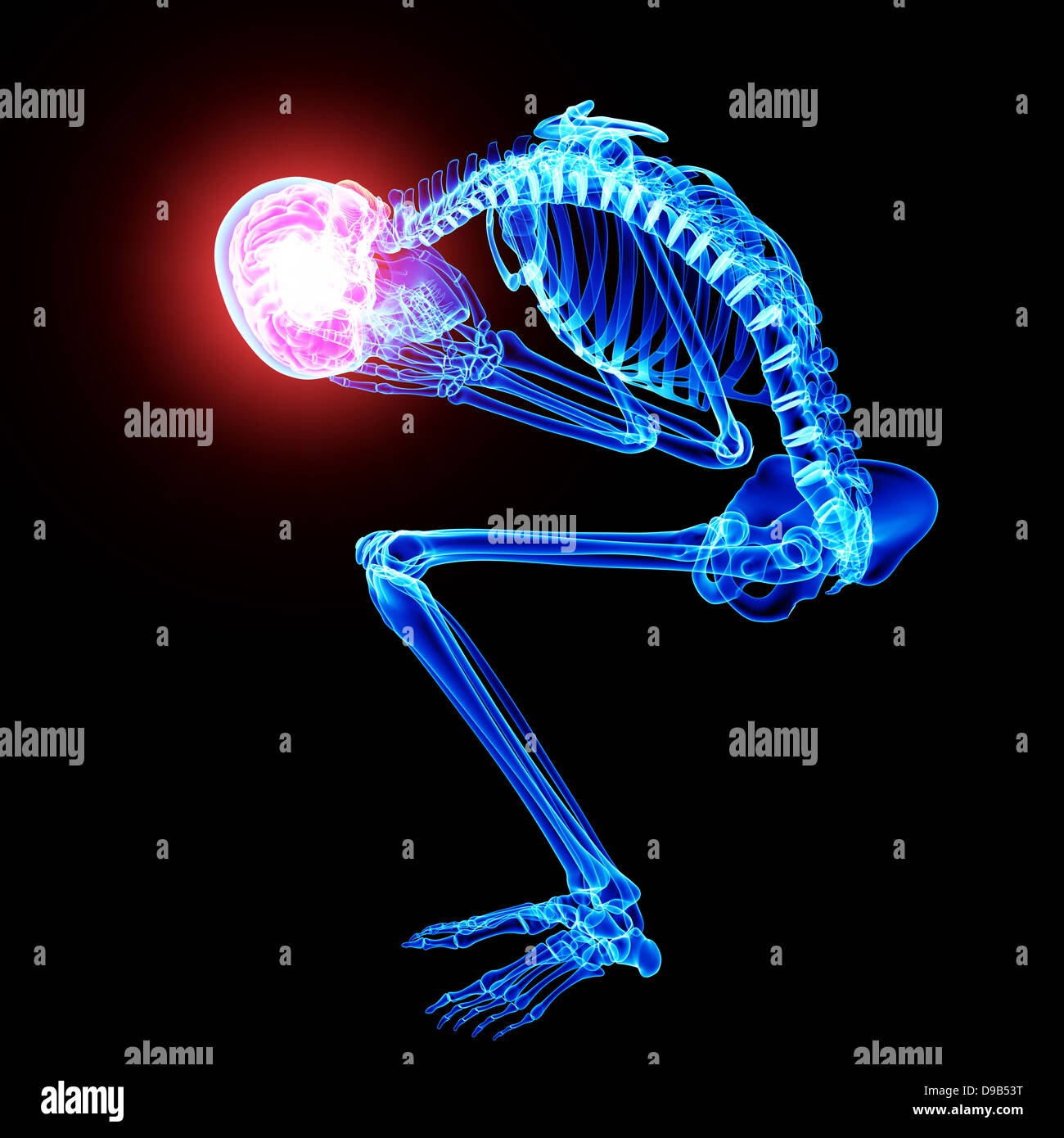 Human headache anatomy Stock Photo - Alamy