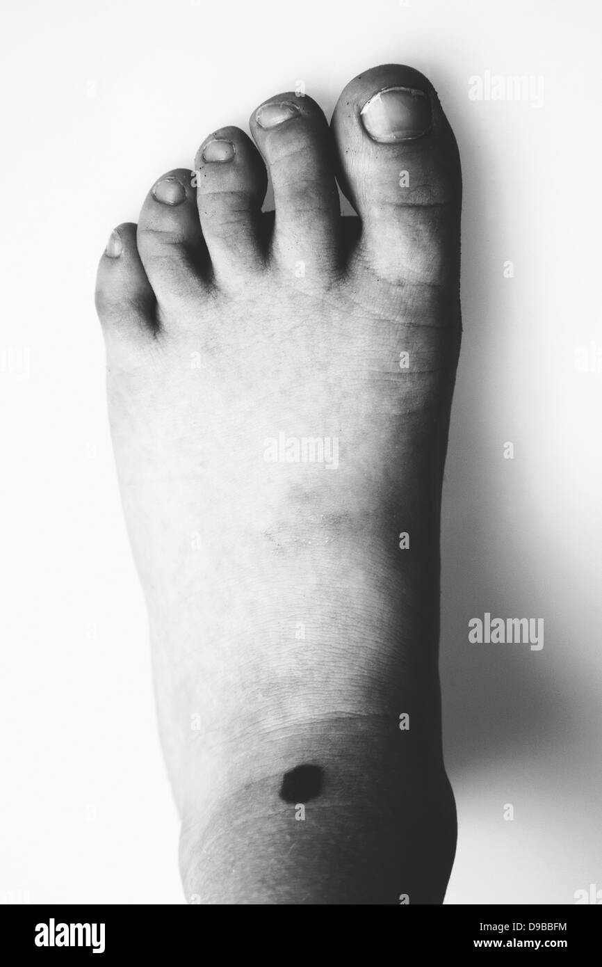Right foot High Resolution Stock Photography and Images - Alamy
