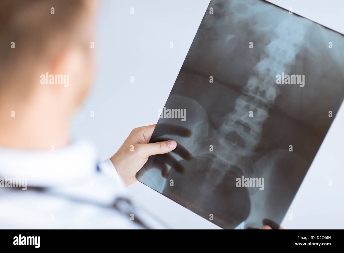 Doctor xray hi-res stock photography and images - Alamy