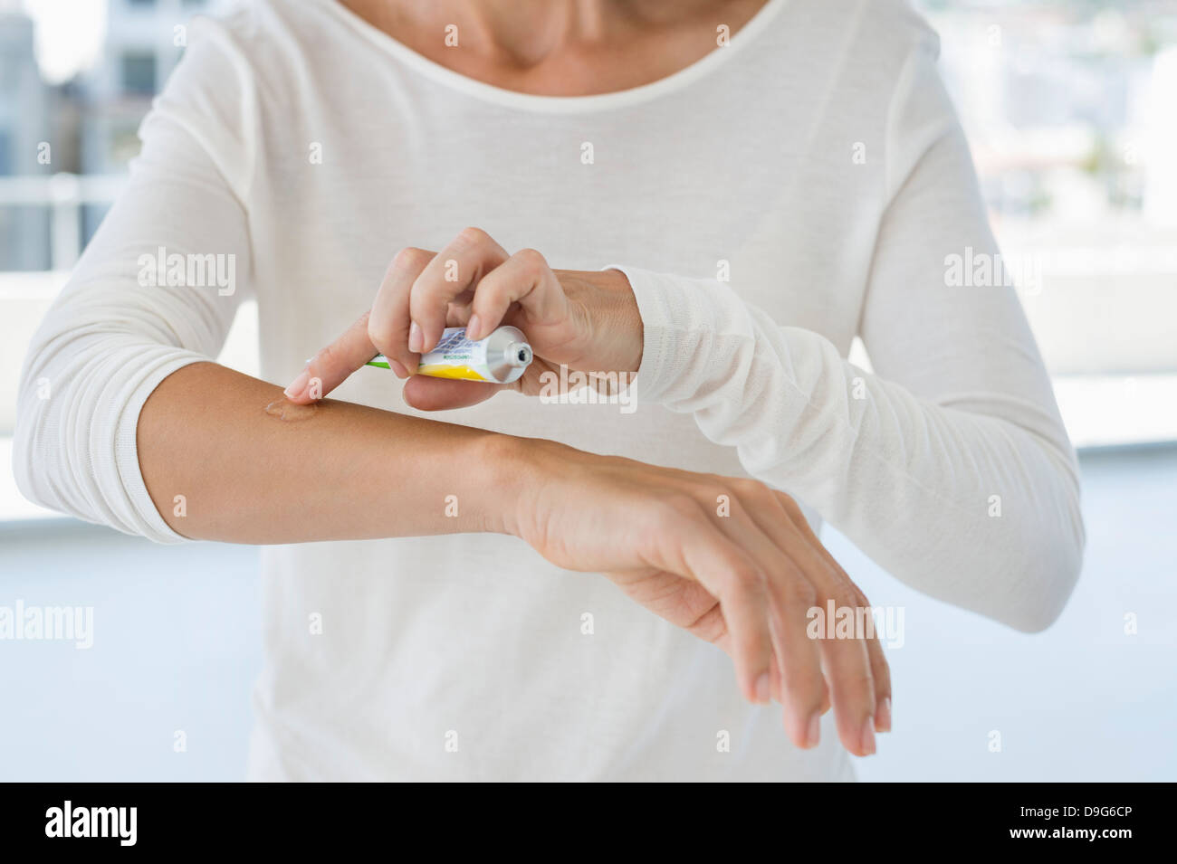 Woman applying ointment on her hand Stock Photo - Alamy