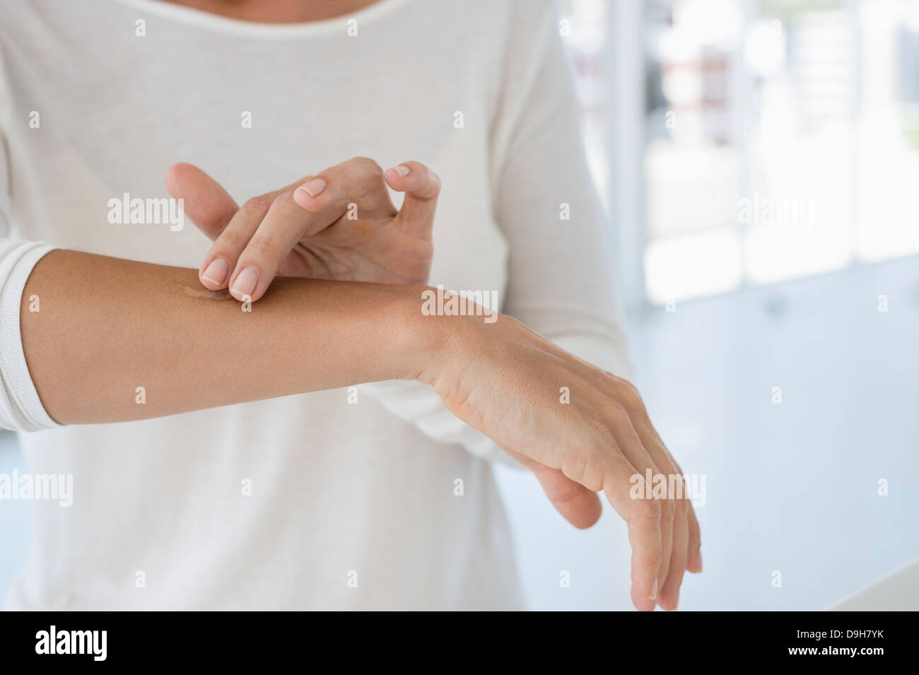 Woman applying ointment on her hand Stock Photo - Alamy