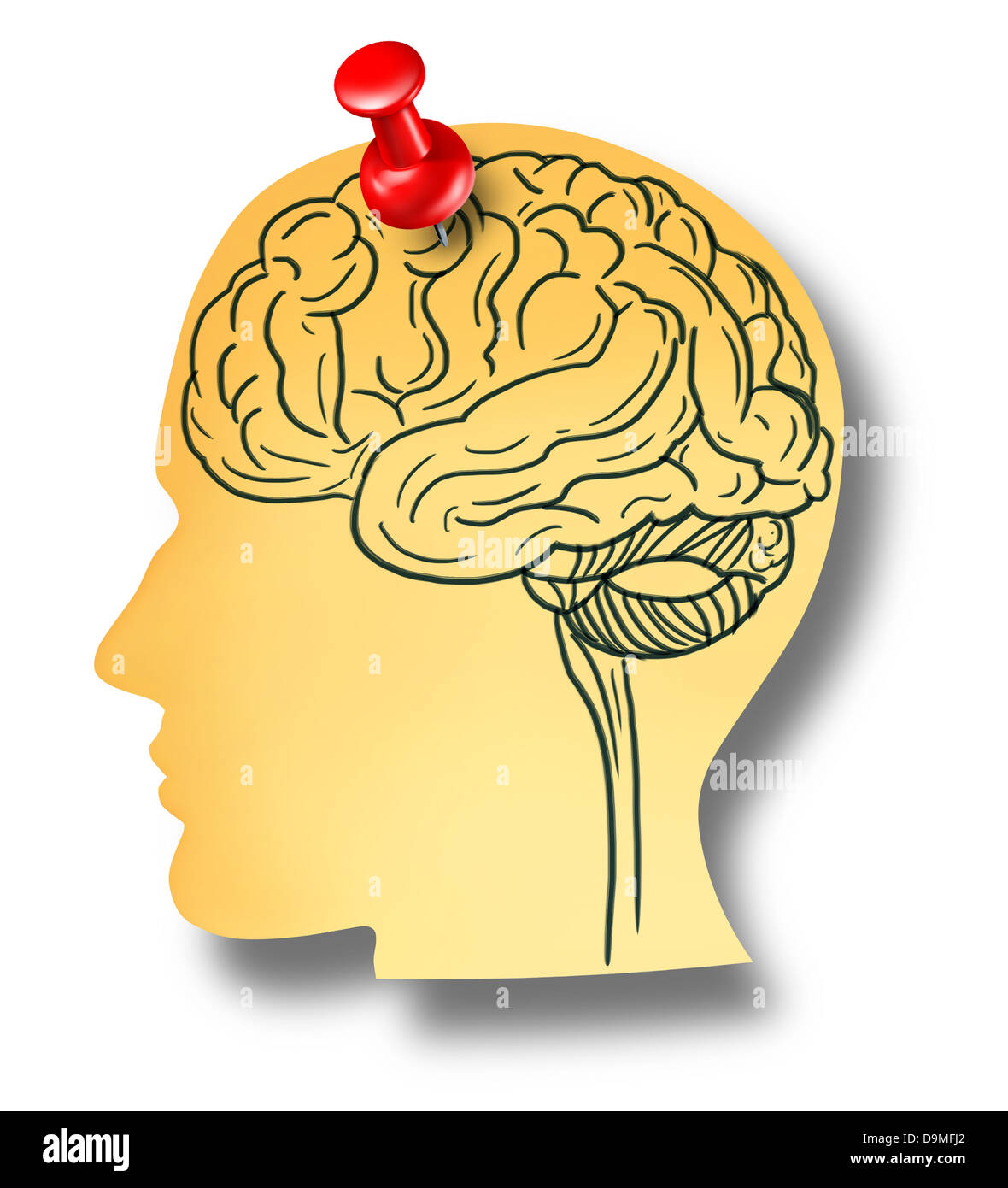 Brain reminder memory loss mental health medical concept of Dementia ... Brain reminder memory loss mental health medical concept of Dementia ...
