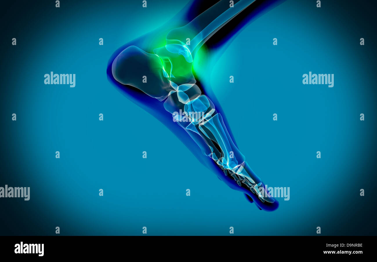 Human body anatomy inflammation x ray hi-res stock photography and ...