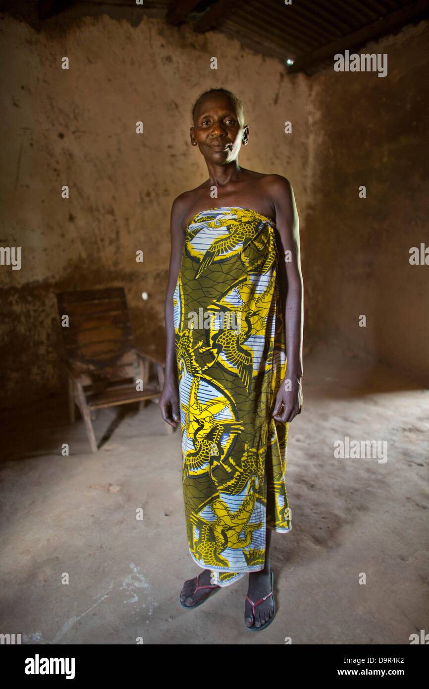 Woman infected with HIV aids in Central African Republic Stock Photo ...