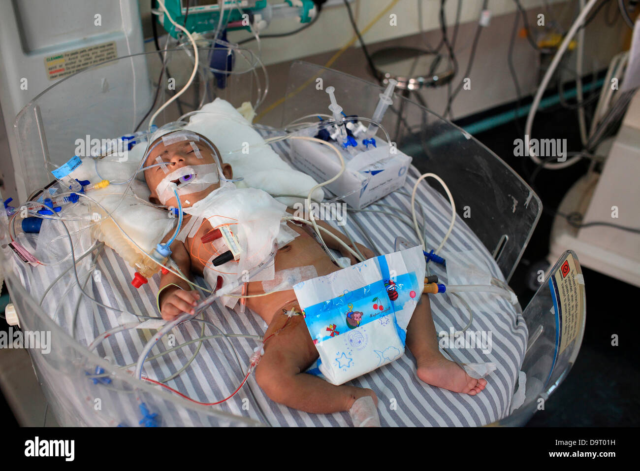Pediatric Icu High Resolution Stock Photography and Images - Alamy