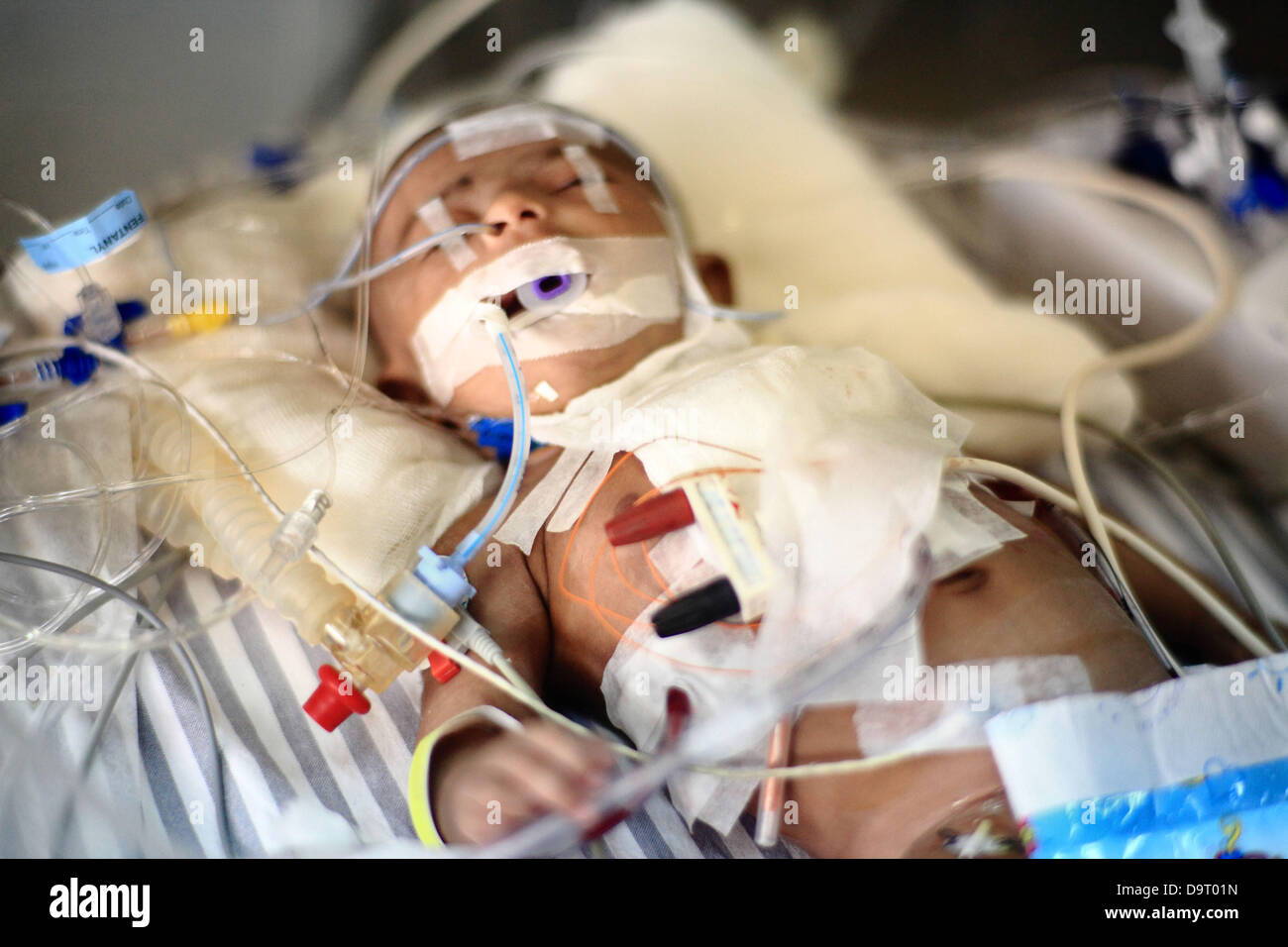 Pediatric icu hi-res stock photography and images - Alamy