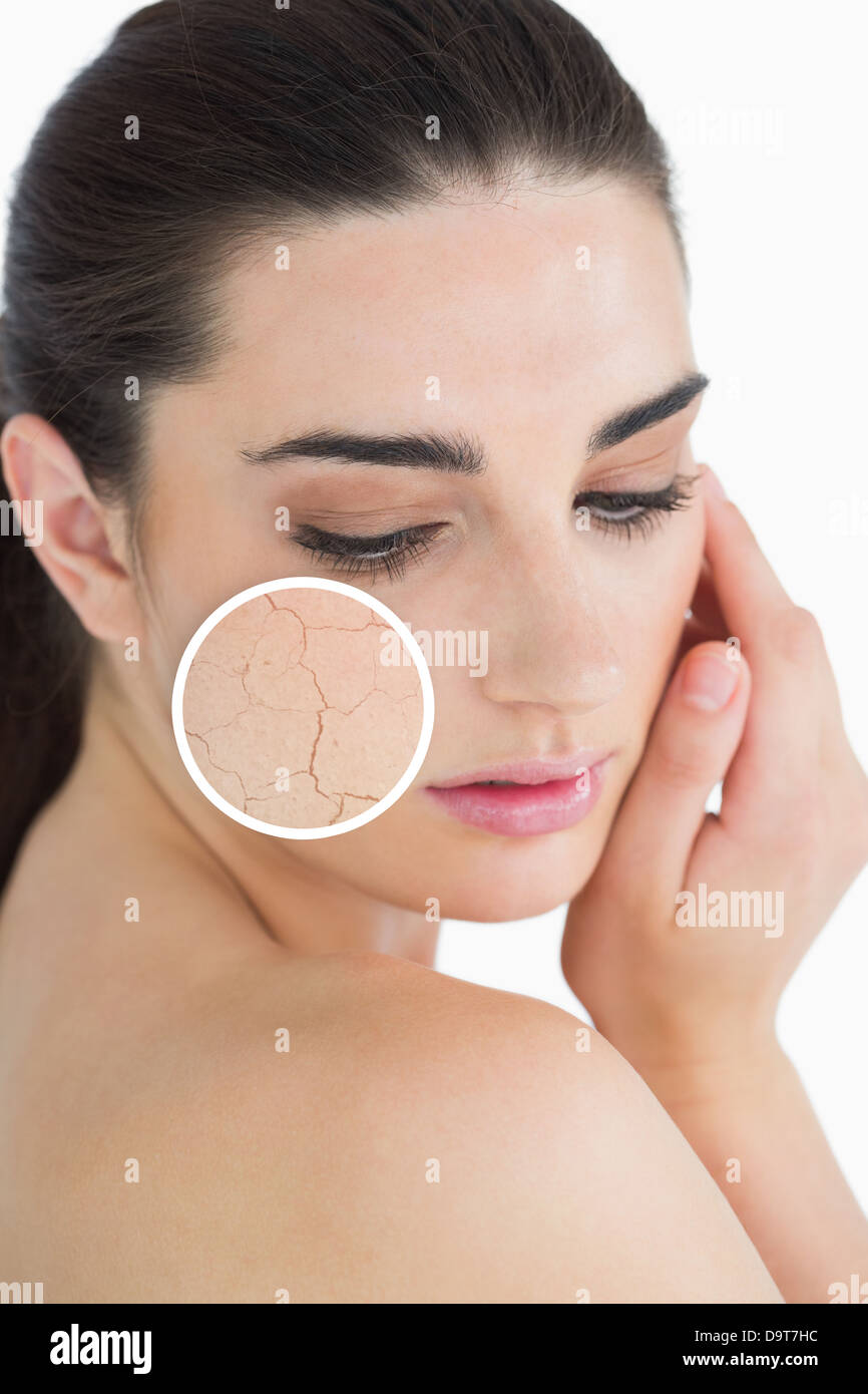 Skin damage hi-res stock photography and images - Alamy