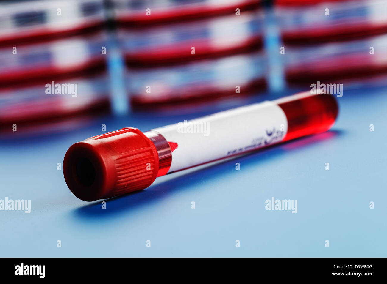 Blood test hi-res stock photography and images - Alamy
