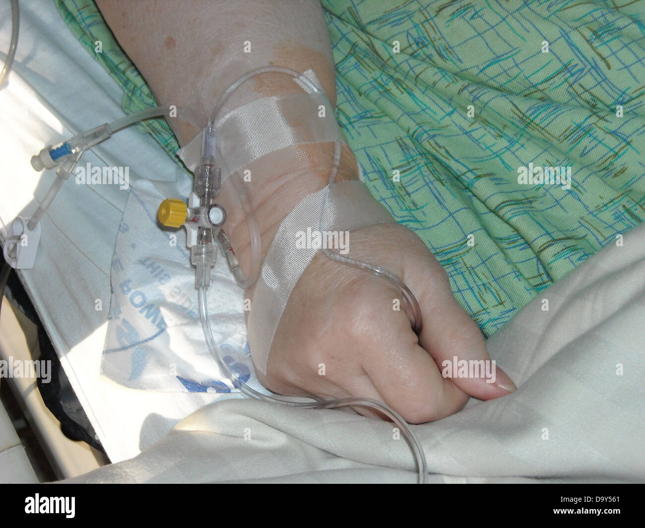 A hospital medical setting showing a patient with an intravenous (IV ...