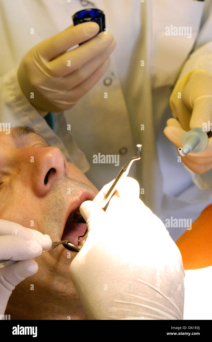 Amalgam fillings woman hi-res stock photography and images - Alamy