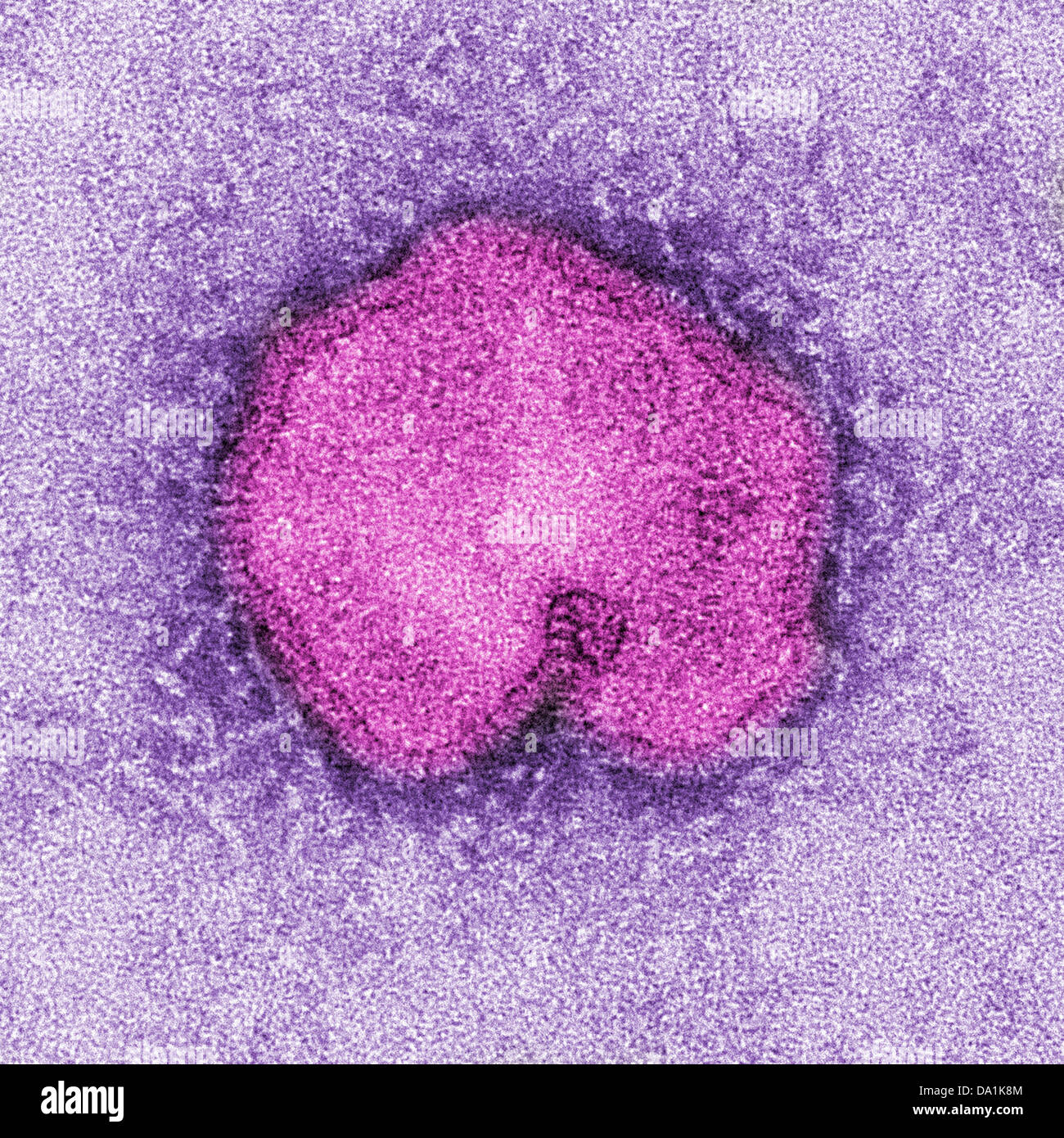 Avian influenza micrograph hi-res stock photography and images - Alamy