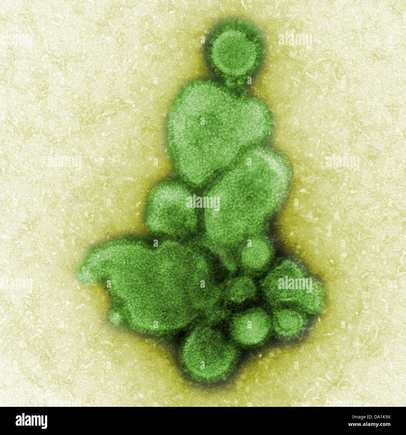 Avian influenza micrograph hi-res stock photography and images - Alamy