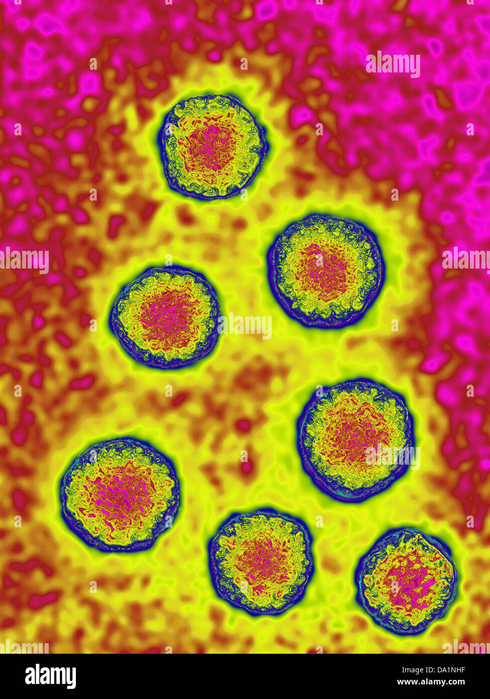 Hepatitis e hi-res stock photography and images - Alamy