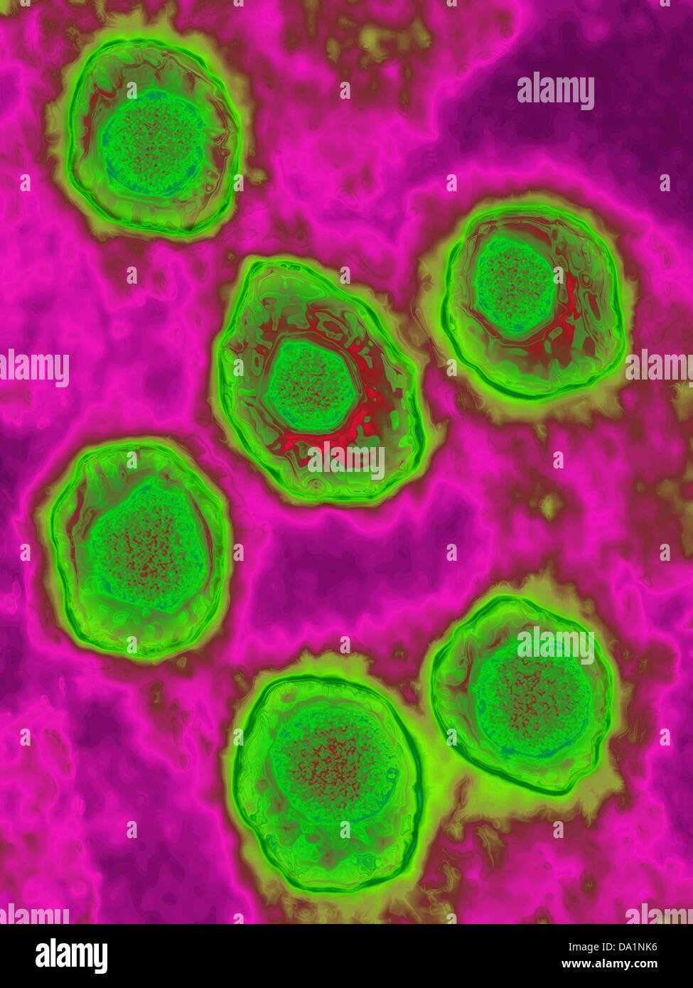 Epstein barr virus hi-res stock photography and images - Alamy