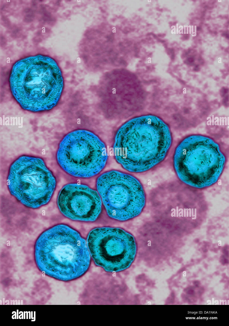 CYTOMEGALOVIRUS Stock Photo - Alamy