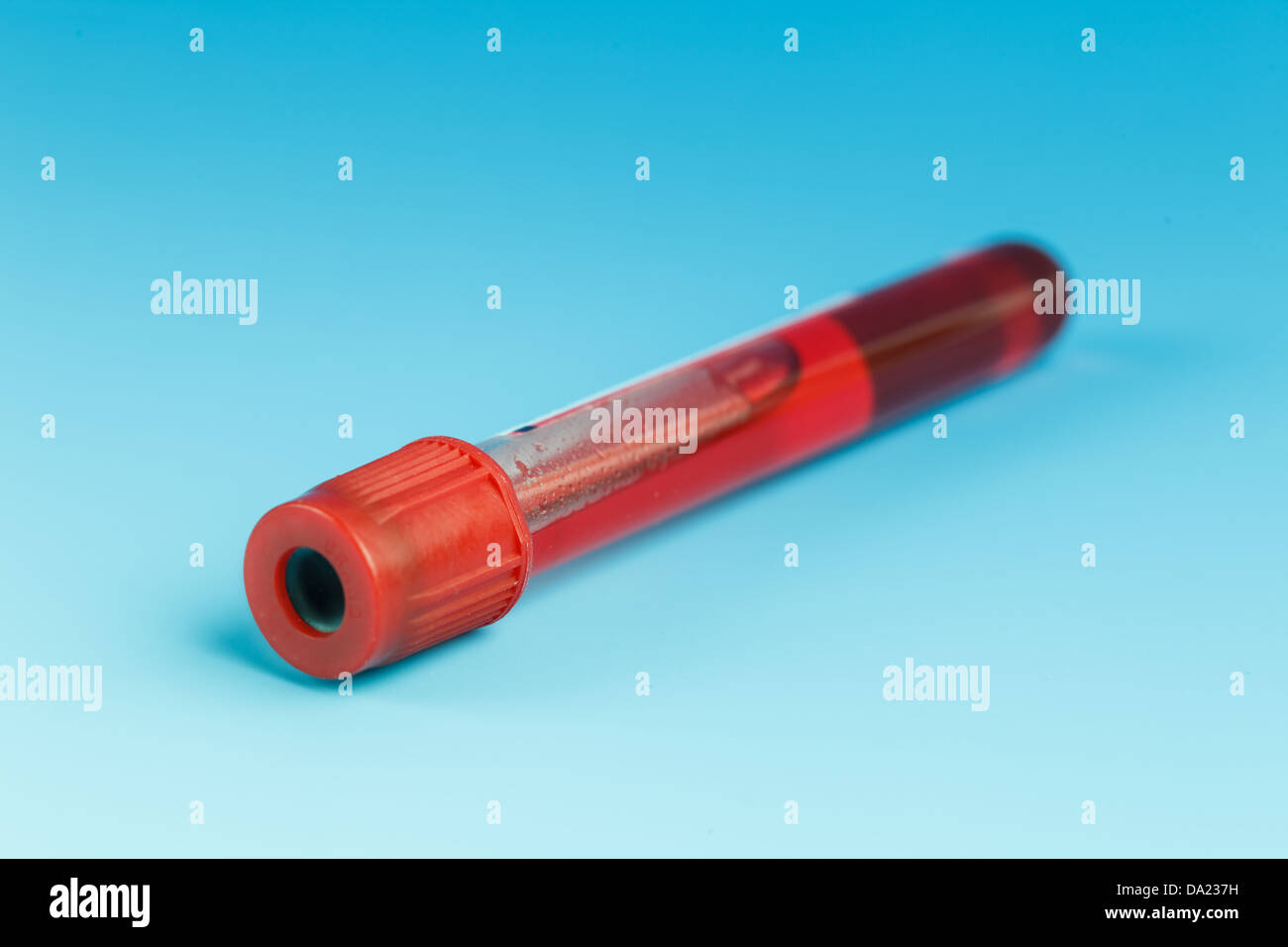 test tube with blood sample Stock Photo - Alamy