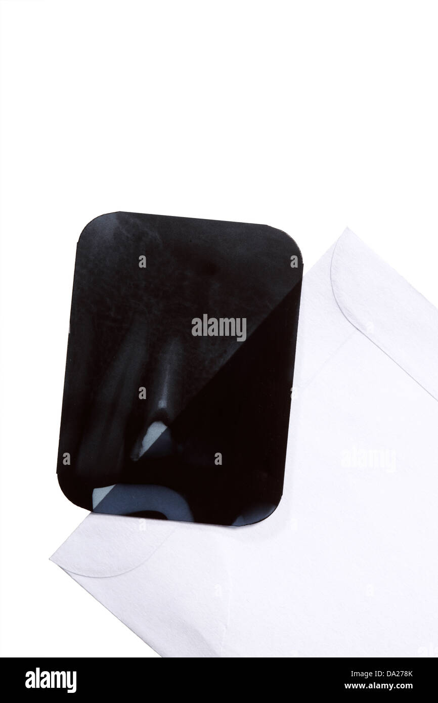 detail x-ray image scan of humans teeth Stock Photo - Alamy