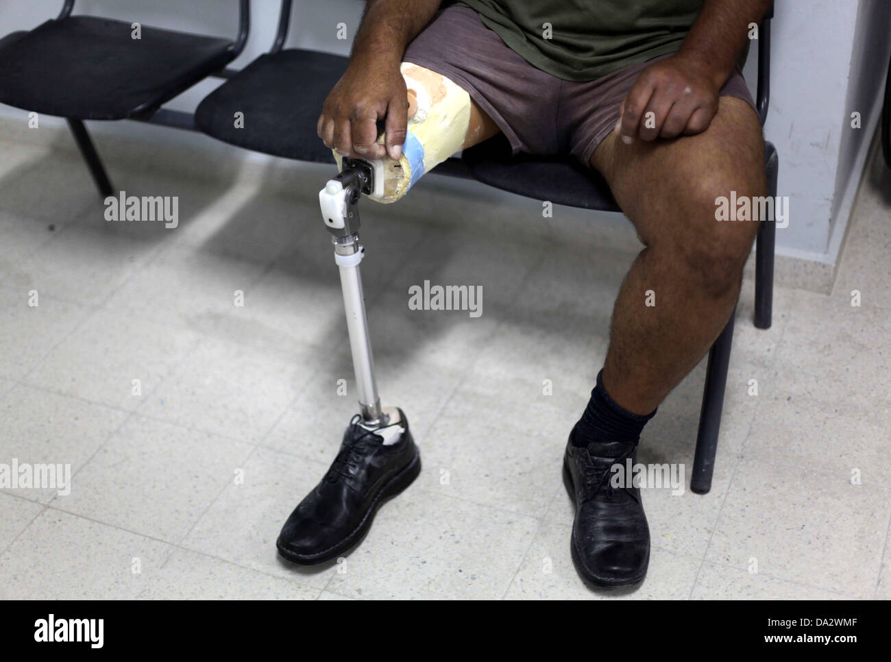 Polio leg hi-res stock photography and images - Alamy