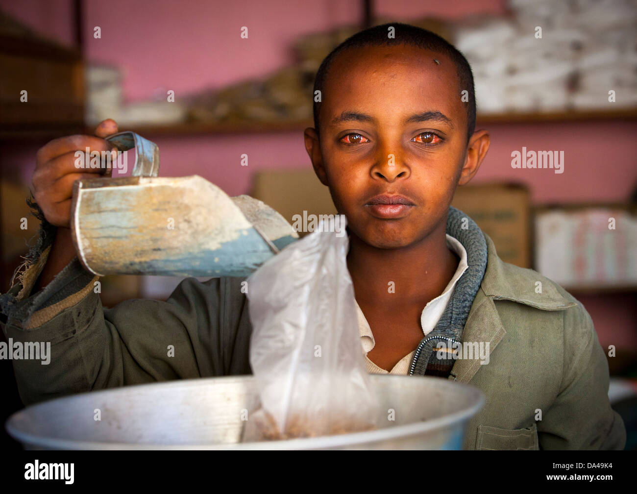 Boy In Speice Market With Red Eyes, Adi Keyh, Eritrea Stock Photo - Alamy