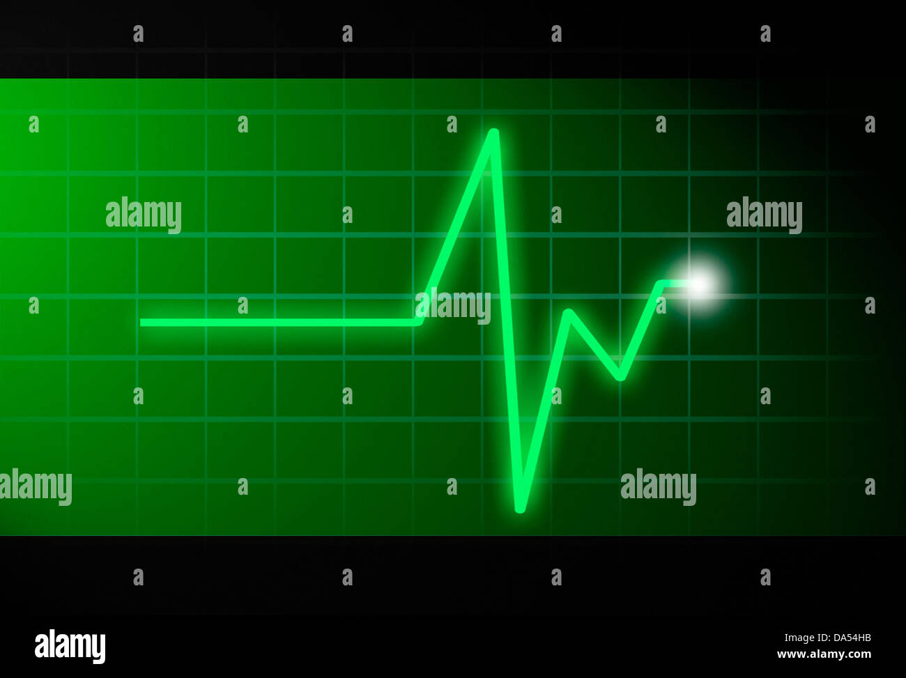 cardiogram frequency display Stock Photo - Alamy