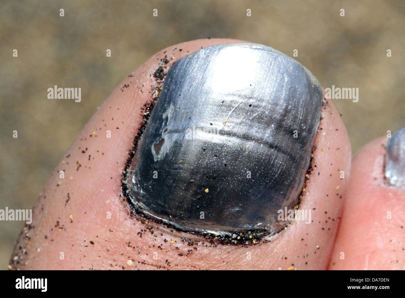 Big toe hi-res stock photography and images - Alamy