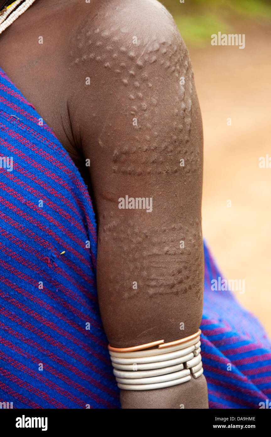 Scars arm hi-res stock photography and images - Alamy