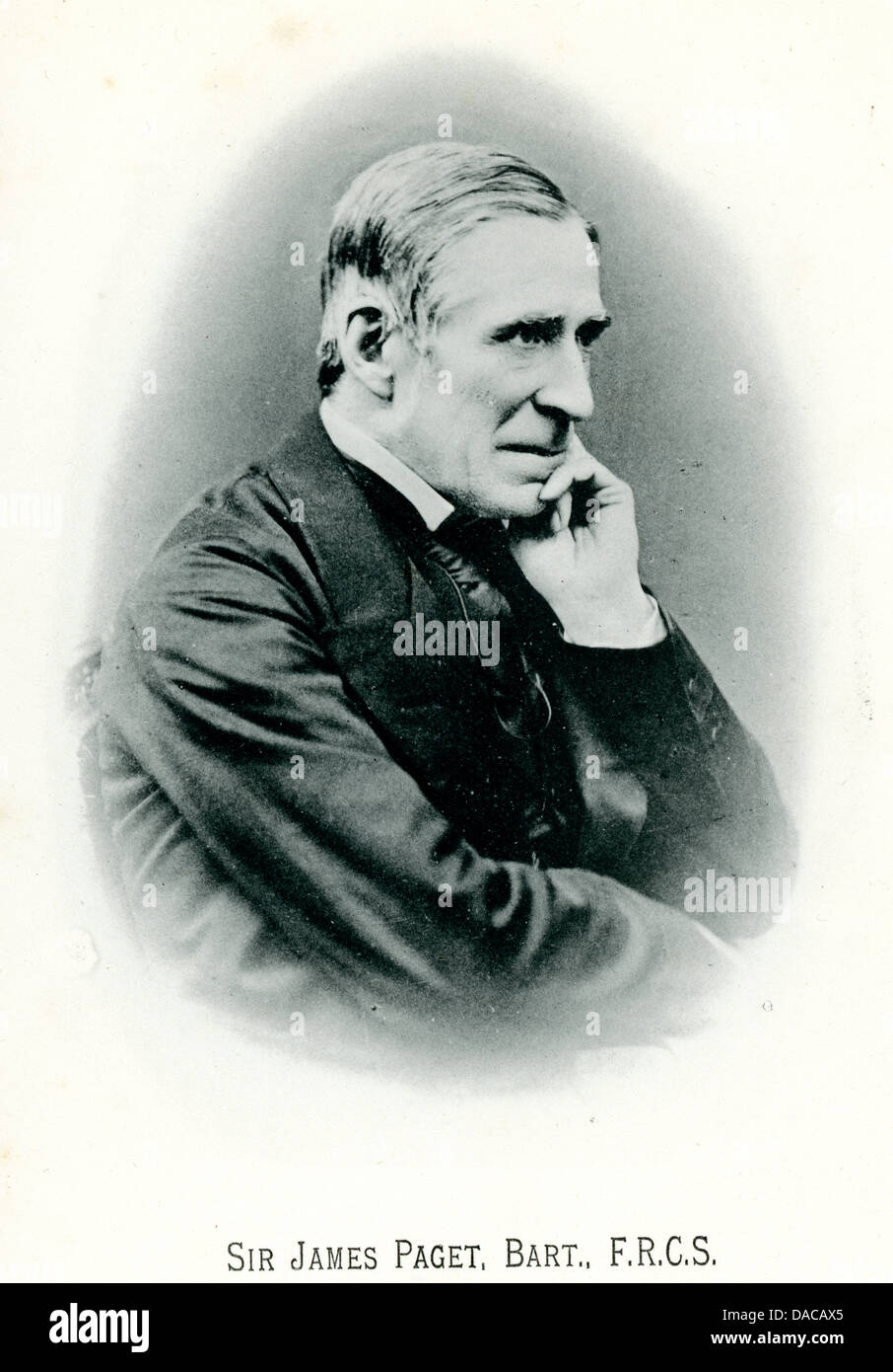 Sir James Paget, 1st Baronet 1814 to 1899 was an English surgeon and ...