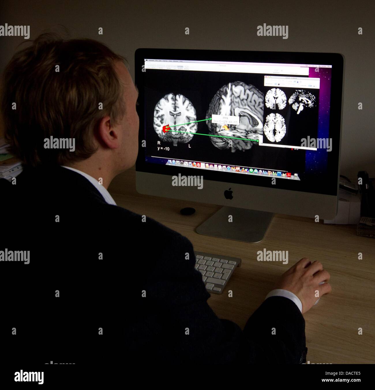 A scientist of the Leibniz-Institute for Neurobiology (LIN) analyses ...