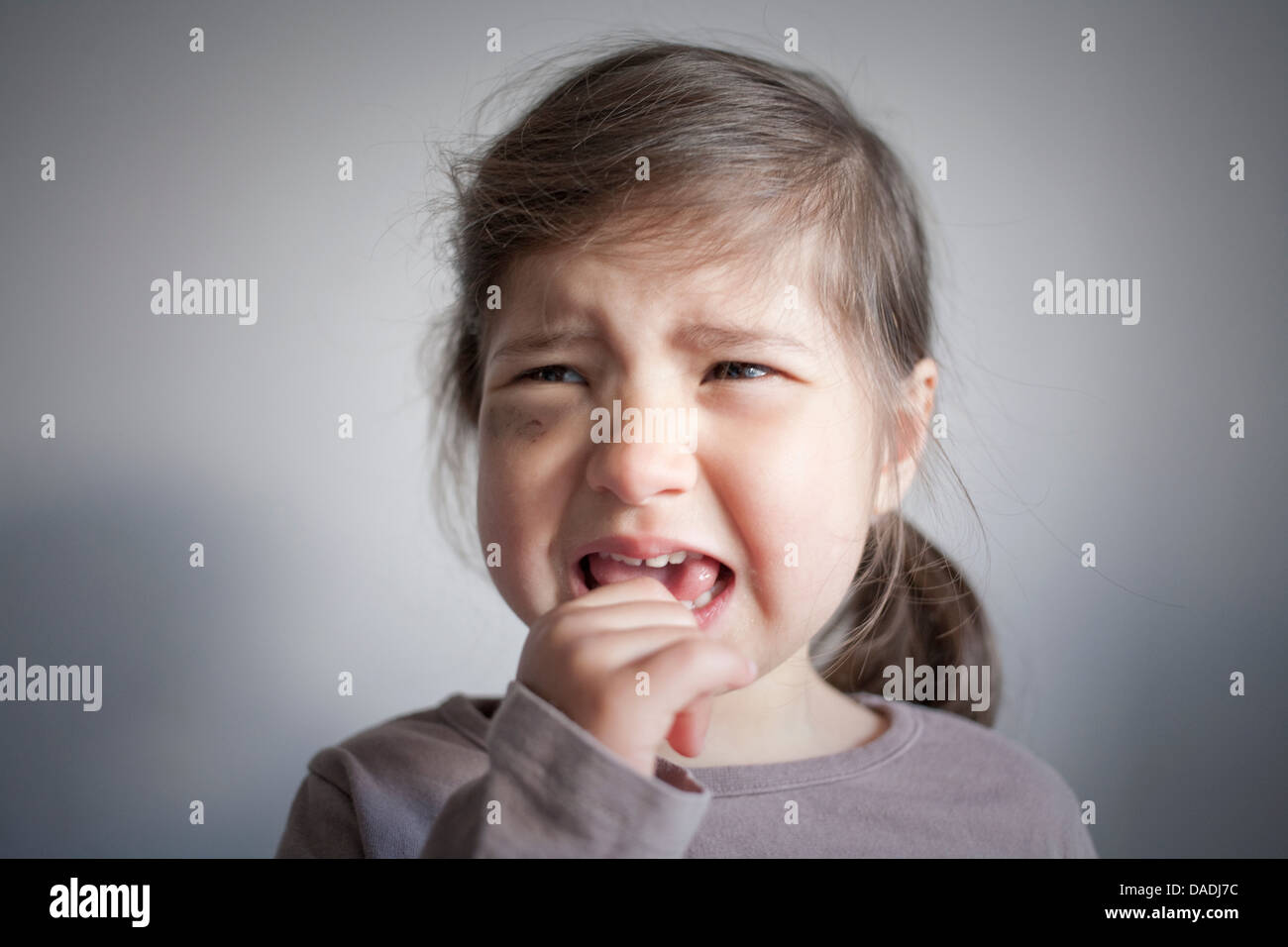 Black eye hi-res stock photography and images - Alamy