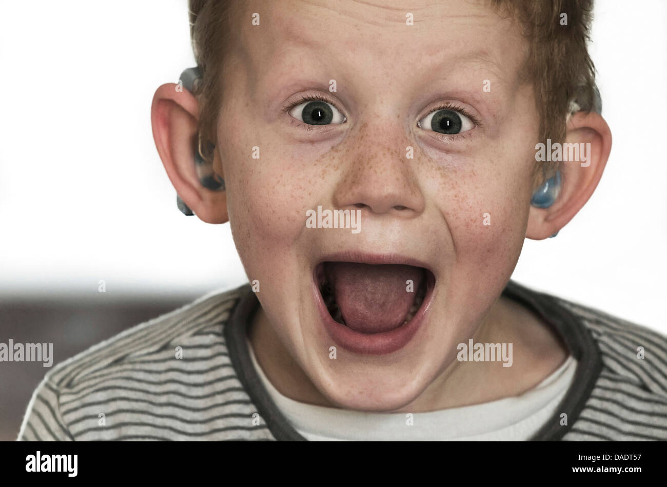 Austria, Boy with hearing aid laughing Stock Photo - Alamy