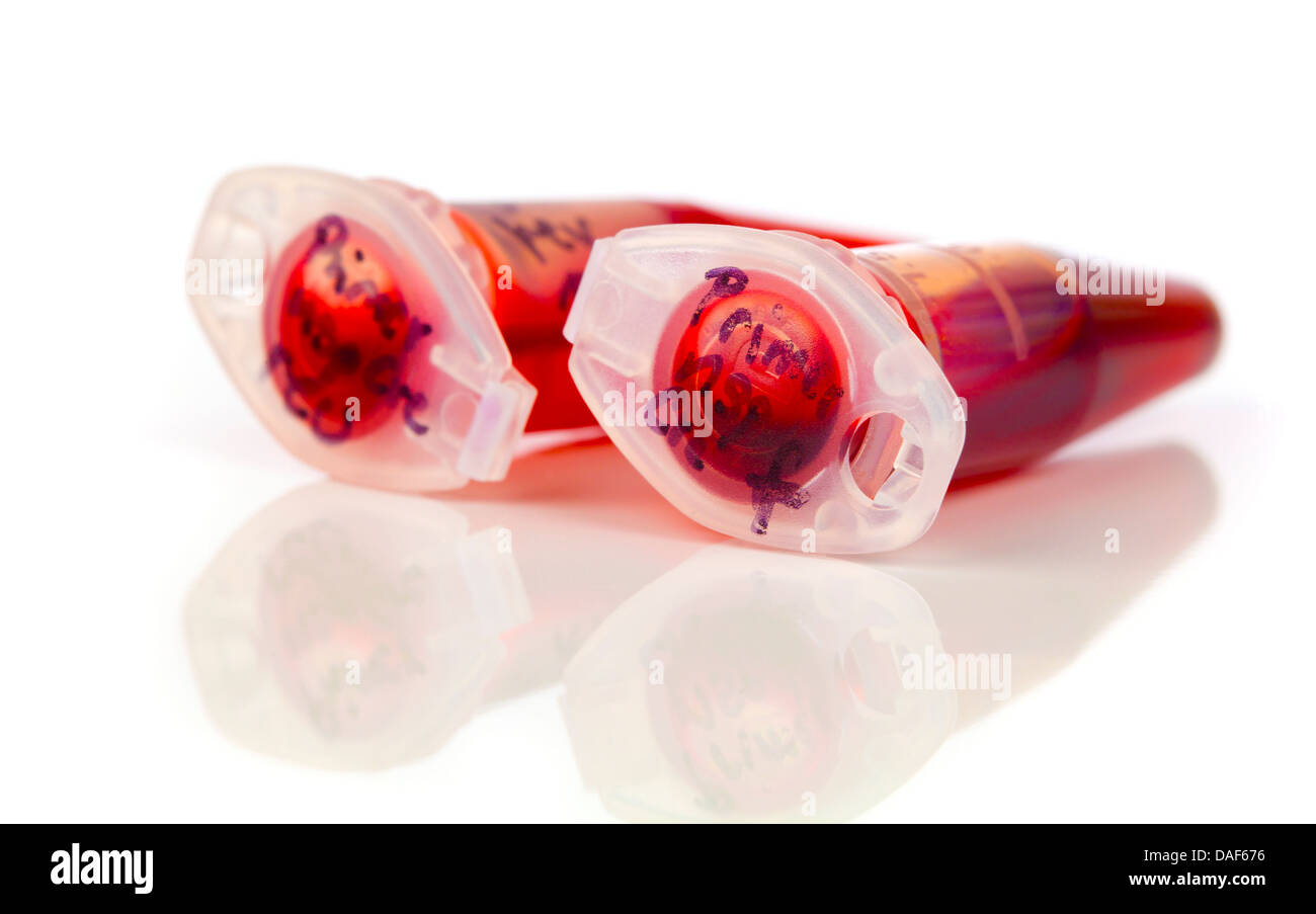 Sample of stem cells in the reaction tube Stock Photo - Alamy