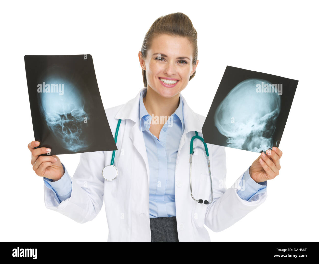 Smiling doctor woman holding fluorography Stock Photo - Alamy